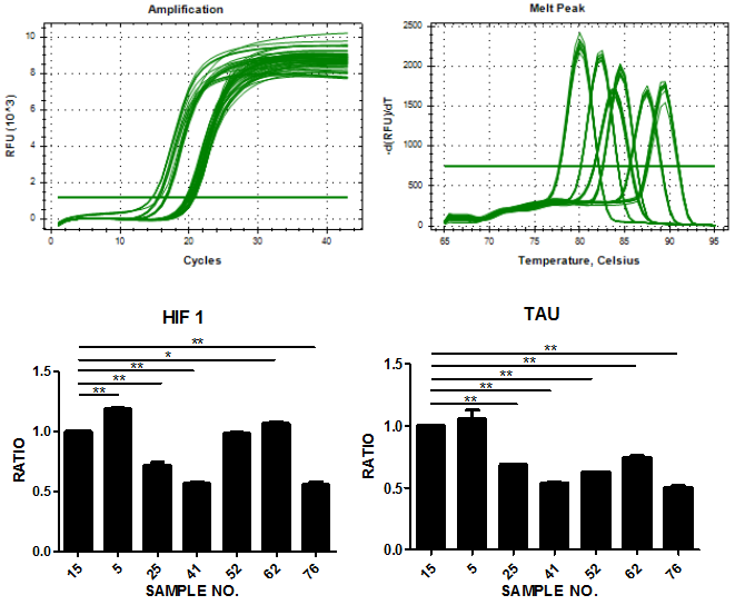 Q-PCR成功案例 - 成功案例 - 浙江鹰旸医药研发有限公司
