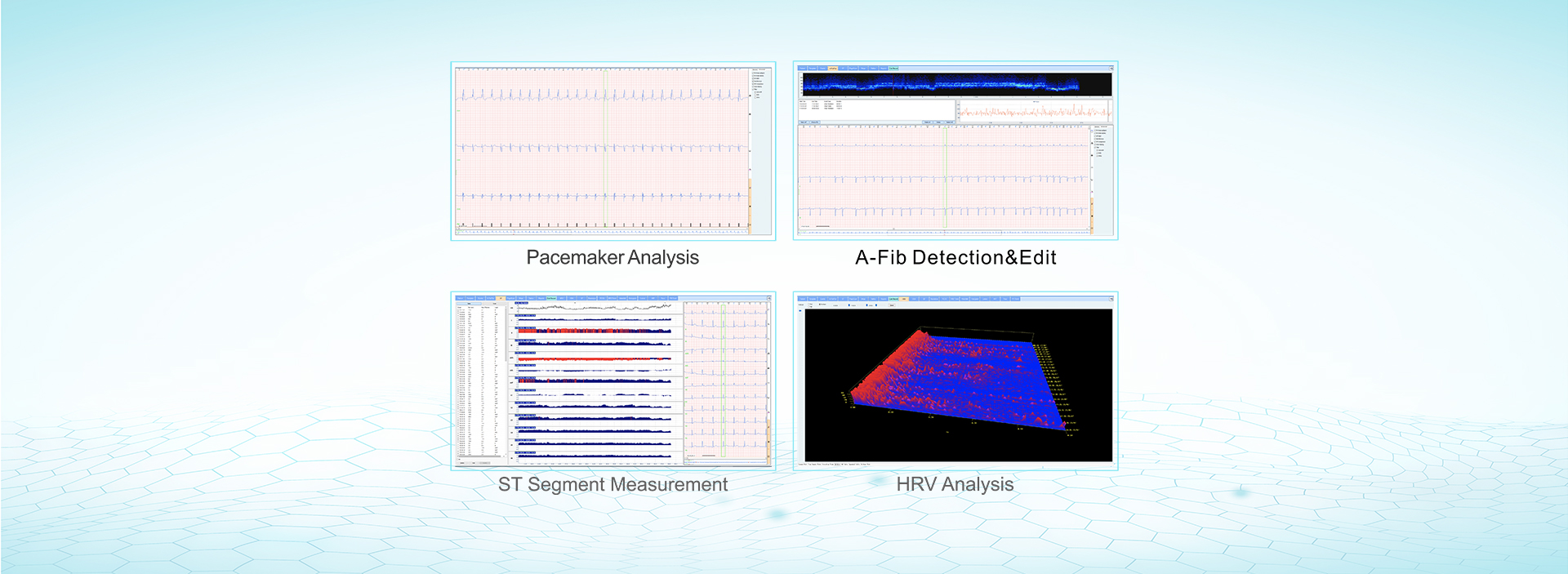 Holter Software - Holter System - Biomedical Instruments Co., Ltd.