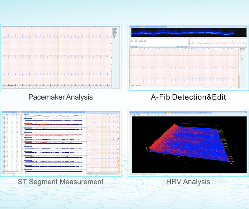 Holter Software - Holter System - Biomedical Instruments Co., Ltd.