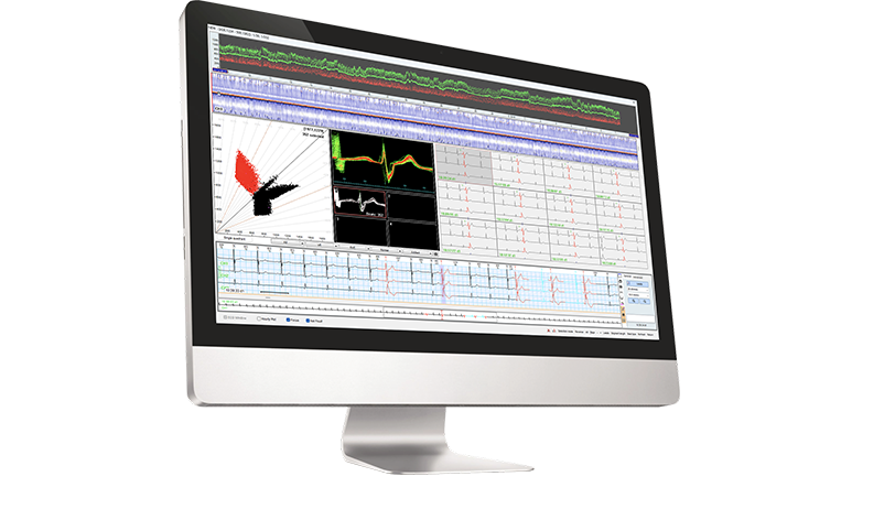Holter Software - Holter System - Biomedical Instruments Co., Ltd.